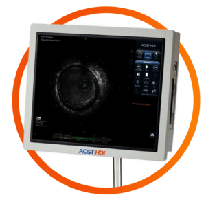 HD IVUS Console | Advanced IVUS Imaging System & Catheter
