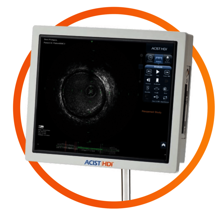 HD IVUS Console | Advanced IVUS Imaging System & Catheter