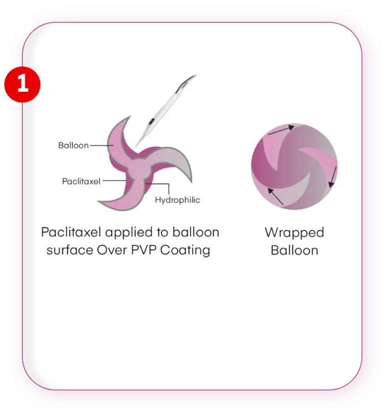 Protégé - DEB Catheter, Drug Coated Balloon - Translumina