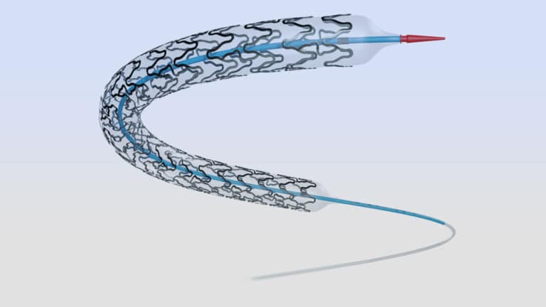 Best Coronary Stent - Cardiovascular Devices - Translumina